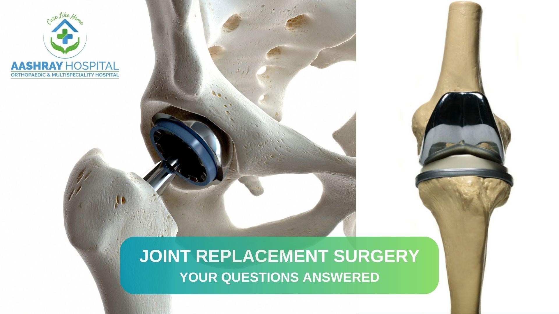 Joint Replacement Surgery in Vadodara: Your Questions Answered